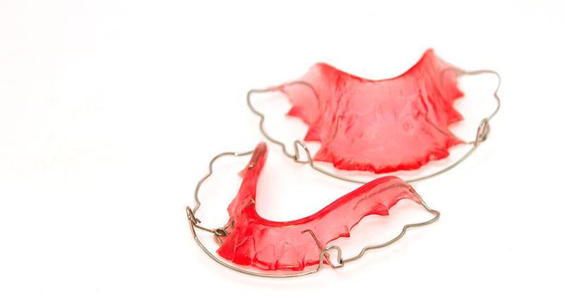 Traditional Retainers | Orthodontist in Davenport & Celebration, FL